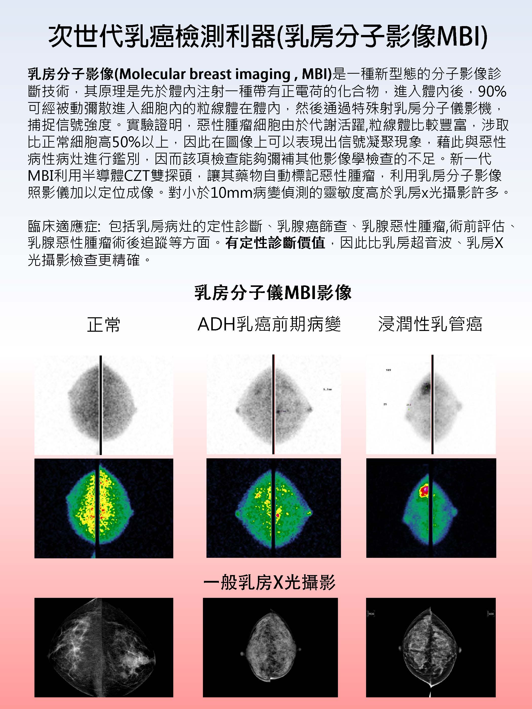 2016-04-01 乳房分子影像MBI(次世代乳癌檢測利器) | 優質服務 | 耕莘訊息 | 天主教耕莘醫療財團法人耕莘醫院